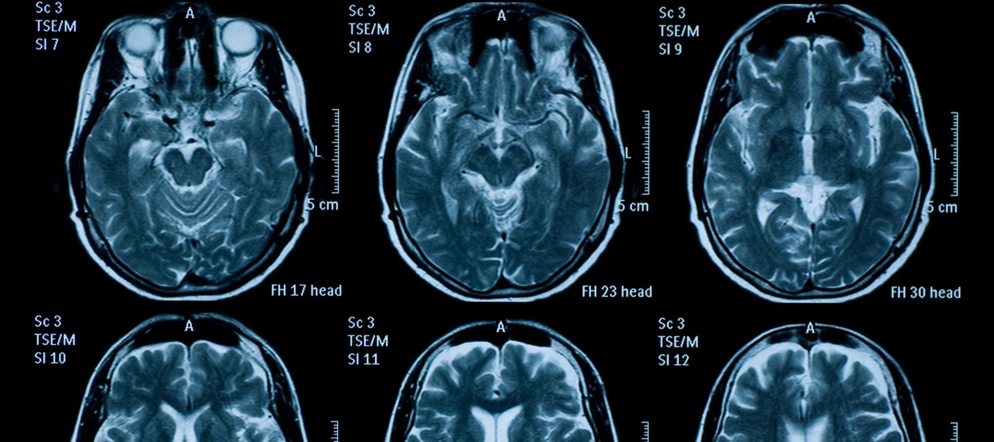 April 10, 2025 | Parasites without Borders