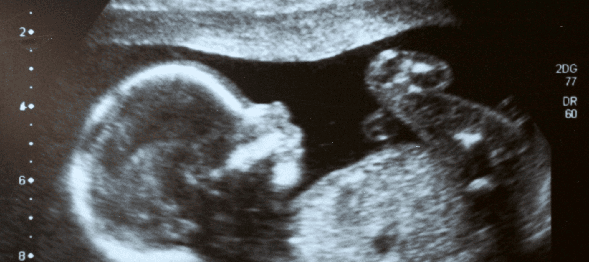 January 8, 2026 | Parasites without Borders